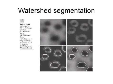 Lecture Z Chapter Image Segmentation Segmentation Approaches