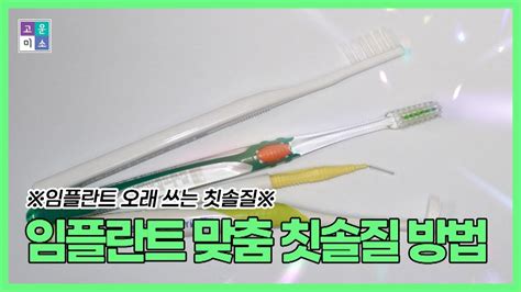 임플란트 오래쓰려면 🪥 Youtube