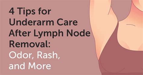 Swollen Lymph Nodes Armpit