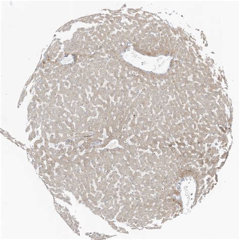 Tissue Expression Of Cgas Staining In Liver The Human Protein Atlas