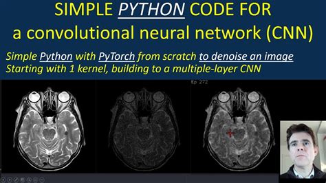 Simple Code For Convolution And A Cnn To Denoise An Image With Real