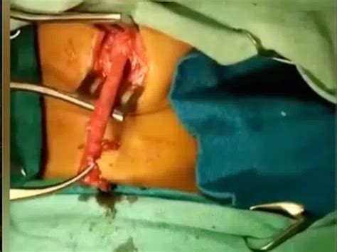 Branchial Anomalies Treatment Specialist In Bangalore