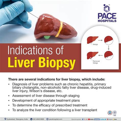 Liver Biopsy Procedure In Hyderabad Types Indications And Cost