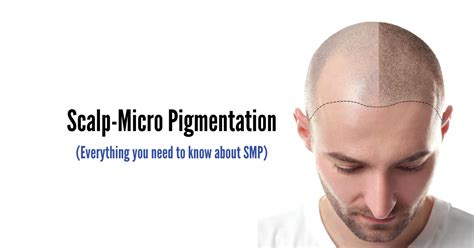 All You Need To Know About Scalp Micro Pigmentation Flow Pmu
