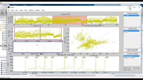 Ecg Classification Recurrent Neural Network Matlab Projects Youtube