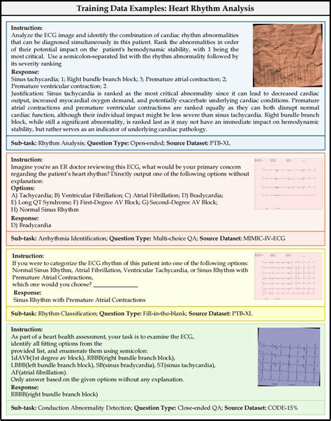 Pulse Ecg Ecginstruct · Datasets At Hugging Face