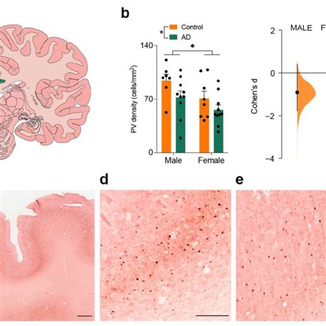 Sex And Alzheimers Disease Contribute To The Density Of Rsc Pv Ins In