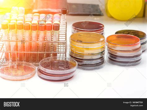 Biochem Test Kit Image And Photo Free Trial Bigstock