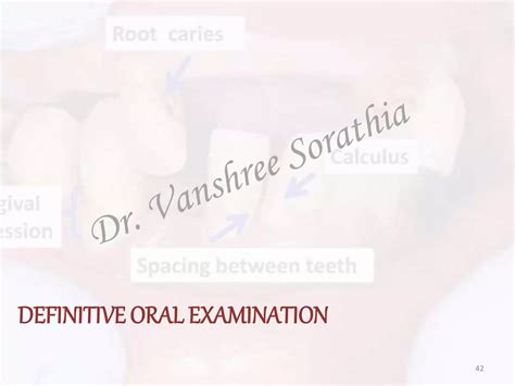 Diagnosis And Treatment Planning Of Removable Partial Denture Pptx