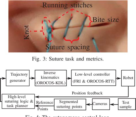 Figure 1 From Autonomous Laparoscopic Robotic Suturing With A Novel Actuated Suturing Tool And