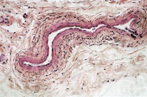 Vein Cross Section LM Stock Image C022 4549 Science Photo Library