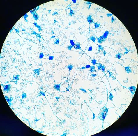 فطر البنسيليوم 😍 المعزول من الجبنة علوم الحياة Biology