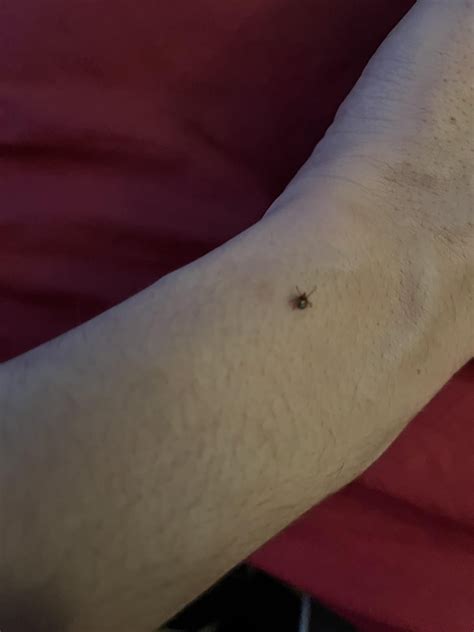 What Is This It Doesnt Look Like A Bed Bug But I Have No Idea Rwhatsthisbug
