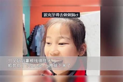 上海妈妈自告奋勇给女儿拔牙，出其不意拍脑袋秒拔下：亲妈无疑