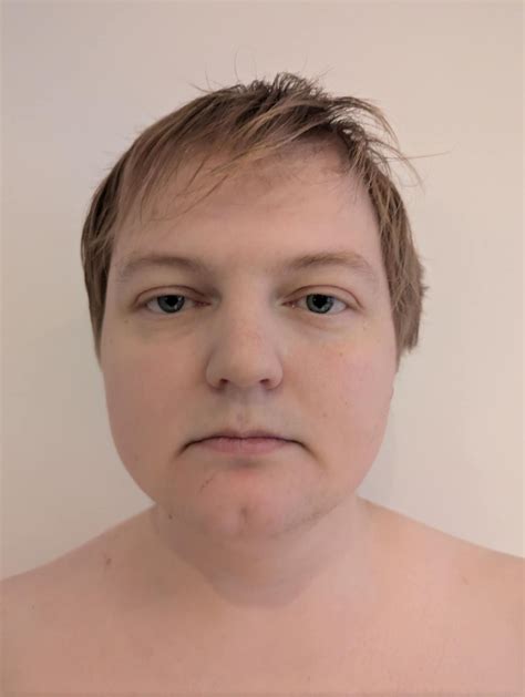 Face Progress 20 Kg Loss Album On Imgur