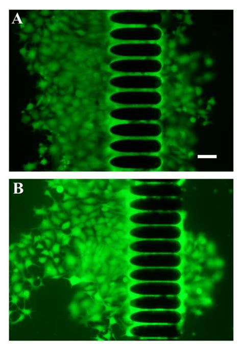 Video Clinical Microfluidic Chip Platform For The Isolation Of Video Clinical Microfluidic Chip Platform For The Isolation Of