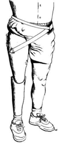 Transtibial Prosthetic Components Flashcards Quizlet