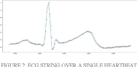 Figure 1 From Qrs Detection In Digital Ecg Signal Using Deterministic Finite Automata Semantic