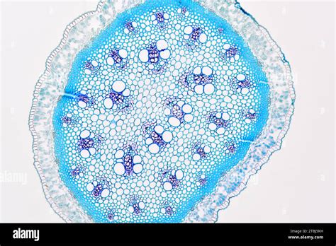 Xylem And Phloem Microscope Hd