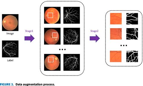 Figure 2 From Retinal Vessel Segmentation Combined With Generative Adversarial Networks And