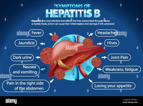 Symptoms Of Hepatitis B Infographic Illustration Stock Vector Image And Art Alamy