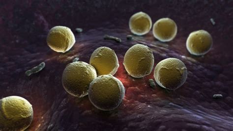 Streptococ Betahemolitic Grup A Divahair Ro