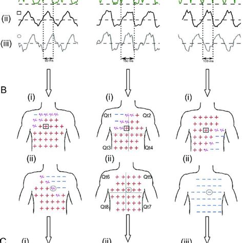 Illustration Of The Correlation Used By The Algorithm For Activation Download Scientific