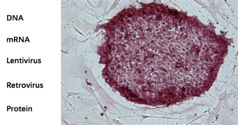 IPSC Reprogramming Kits Creative Bioarray Creative Bioarray