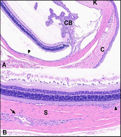 Figure 4 From Histological Findings In The Eyes Of Abcc6 Knockout Rat Model Of Pseudoxanthoma
