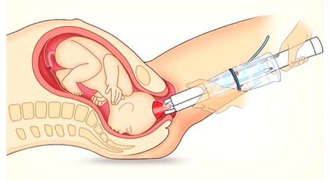 Man Puts Head In Vagina Wyzega