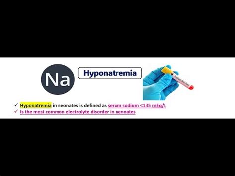 Neonatal Hyponatremia YouTube