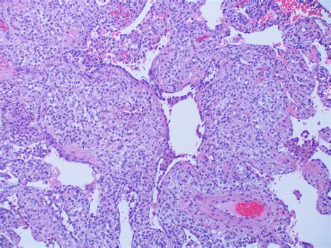 Langerhan Cells Histology