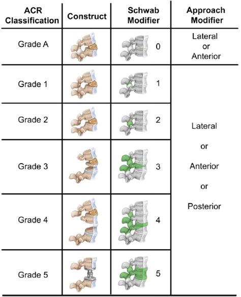 Anterior Column Realignment Neurosurgery Clinics