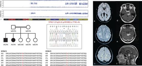 Human Mutation Vol 34 No 9