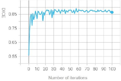 Figure 1 From Pneumothorax Segmentation Of Chest X Rays Using Improved