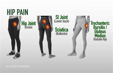 Lower Back Causing You Grief These Hip Stretches Can Help