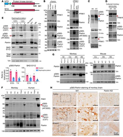Deficiency Of Parkin Causes Neurodegeneration And Accumulation Of Pathological α Synuclein In