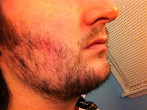 First Time Trying To Grow A Beard Update Weeks Beard Board