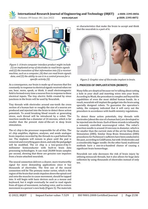 Neuralink A Platform That Integrates Brain Machine Interfaces Pdf