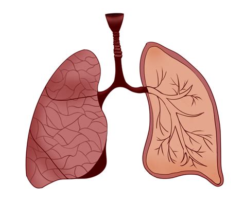 Más De 200 Ilustraciones De Pulmones Y Anatomía Gratis Pixabay