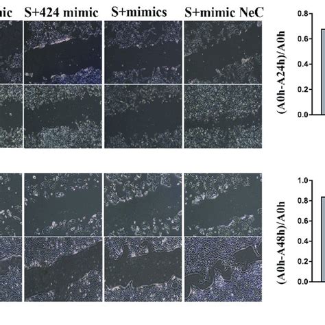 Endoscopic Photograph Of Laryngeal Mass In The Right Piriform Fossa