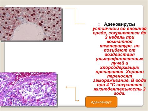 Аденовирусная риновирусная инфекция парагрипп презентация онлайн