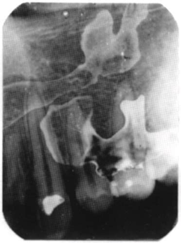 Film Processing Errors Flashcards Quizlet