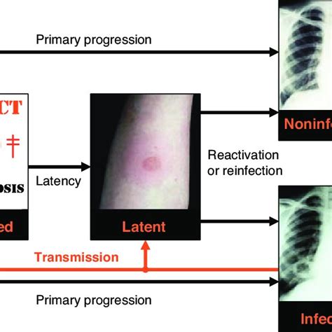 Pdf The Population Dynamics And Control Of Tuberculosis