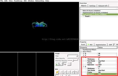 【trackvis 教程】基于dti的纤维追踪及显示 csdn博客