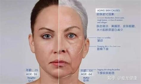 什么是糖化如何减少AGEs的产生 知乎