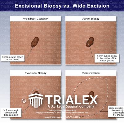 Medical Legal Exhibits Legal Animations Trial Graphics Tria