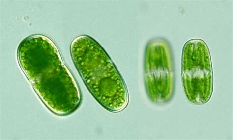 Protist Images Penium Polymorphum