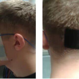 Placement Of Anode And Cathode Electrodes Download Scientific Diagram