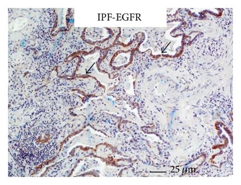 Representative Tissue Microarray Section Immunostained With Monoclonal